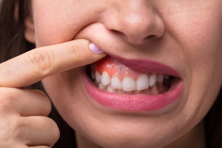 How Smoking and Vaping Affect Teeth and Gums